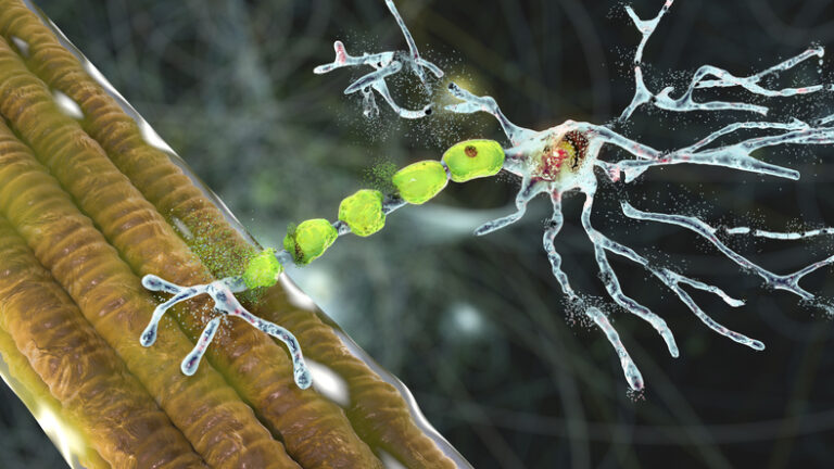 Multiomic ALS Study Links Peripheral Immune Infiltration to CNS ...